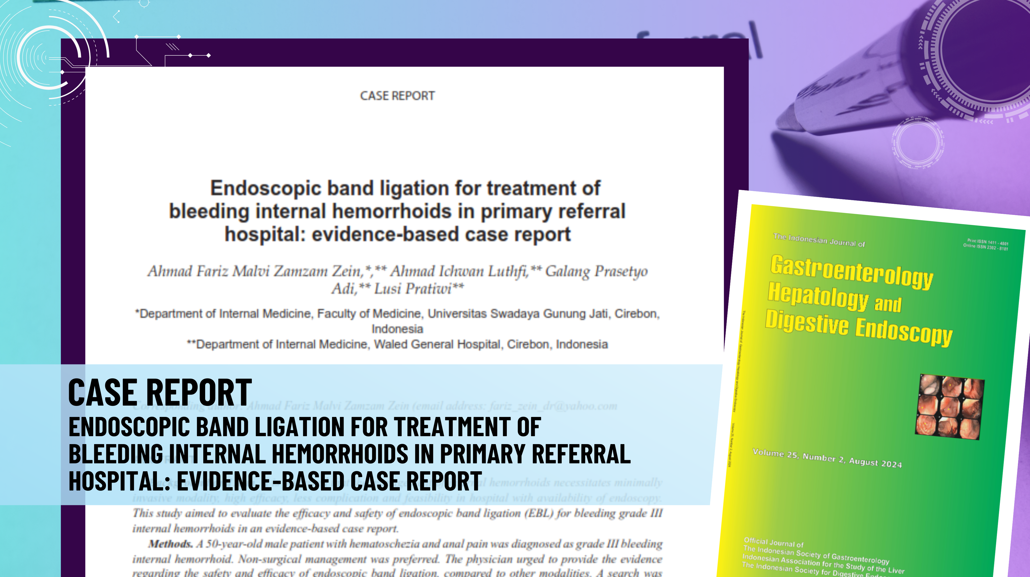 Endoscopic Band Ligation for Treatment of Bleeding Internal Hemorrhoids ...